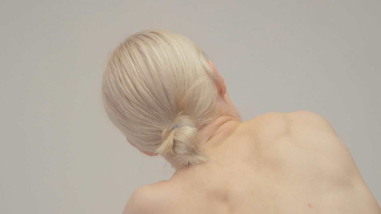 Cervical Dystonia - Dystonia Rehab